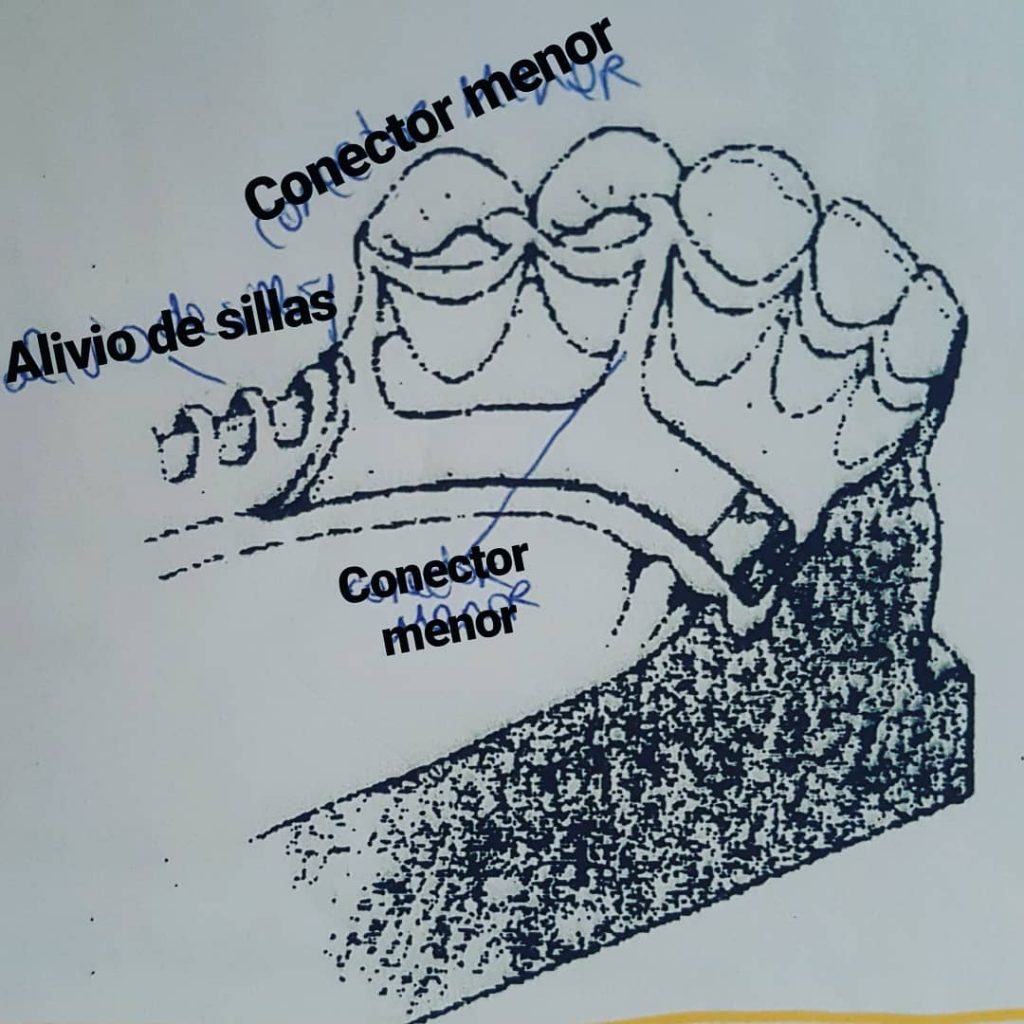 Conectores MAYORES en PPR - Características y Tipos