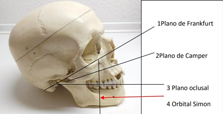 Articuladores DENTALES tipos y arcos faciales