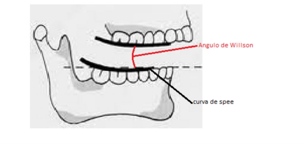 》Proceso de ENMUFLADO de una protesis dental PASO A PASO - Amplia guía ...