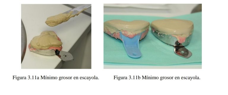 》Proceso de ENMUFLADO de una protesis dental PASO A PASO - Amplia guía ...