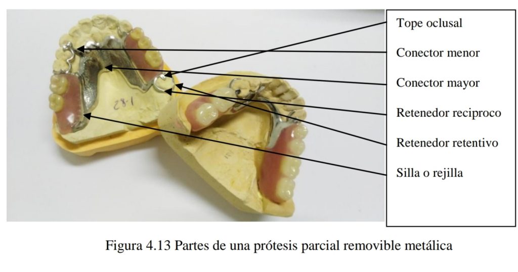 Conectores MAYORES en PPR - Características y Tipos