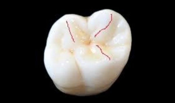 ANATOMÍA DENTAL | Morfología completa y funciones de un diente