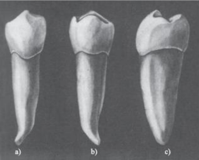 ANATOMÍA DENTAL | Morfología completa y funciones de un diente